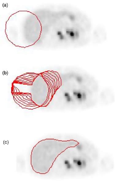the manual segmentation results for images a d1 9 b d2 9 and