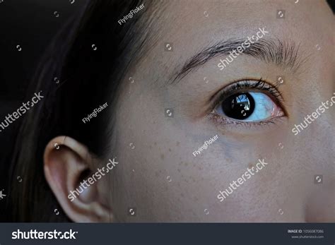 102 Dermatome 이미지 스톡 사진 및 벡터 Shutterstock