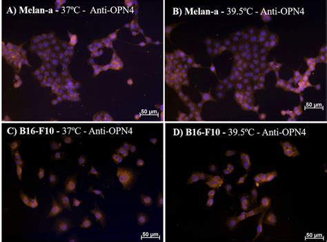 Representative Fields Of Melanopsin Opn4 Immunostaining In Melan A