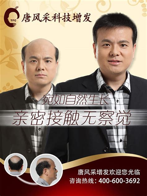 男人秃顶大揭秘，谢顶了该怎么办？ 唐风采增发
