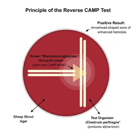 Reverse Camp Test Principle Procedure Result Uses Biology Notes