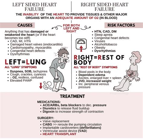Types Of Heart Failure Left Vs Right Sided Upmc Healt Vrogue Co