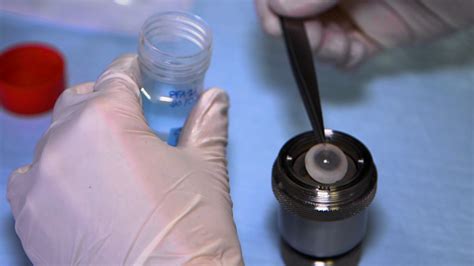 Video Full Field Optical Coherence Microscopy For Histology Like Analysis Of Stromal Features