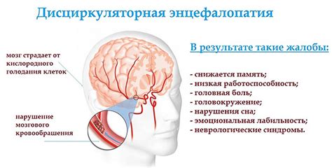 Дисциркуляторная энцефалопатия 2 степени (ДЭП): симптомы и лечение