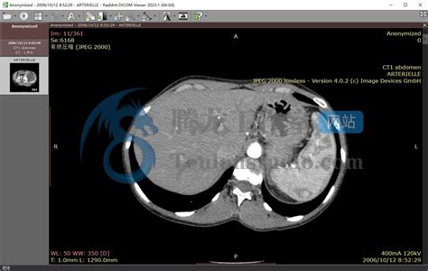 DICOM医学影像浏览器 RadiAnt DICOM Viewer v2024 1 便携版 腾龙工作室