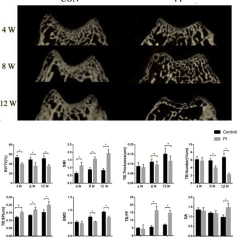 Micro Ct Showed The Configuration Of Femoral Trochlear And The Download Scientific Diagram