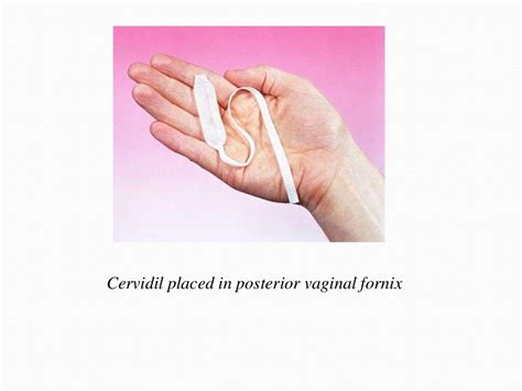 Cervical Ripening And Labour Induction