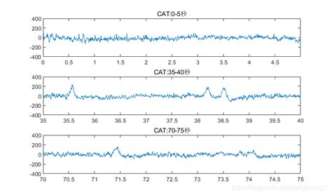 P300脑机接口及数据集处理 Helloworld开发者社区 P300脑机接口及数据集处理 Helloworld开发者社区