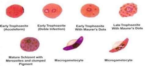 Plasmodium Falciparum Microgametocyte