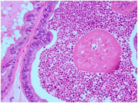 Sequential Sections Of Dlp From Infected Animals At 5 Days A 3 Weeks