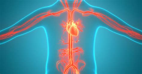 Acute Aortic Dissection