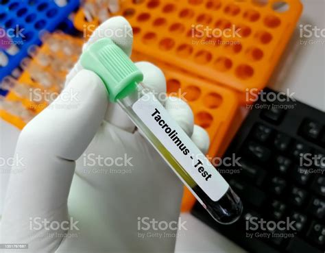 기술자는 타크로리무스 수준 테스트 면역 억제 약물에 대한 검은 배경혈액 샘플을 보유 Stem 주제에 대한 스톡 사진 및 기타