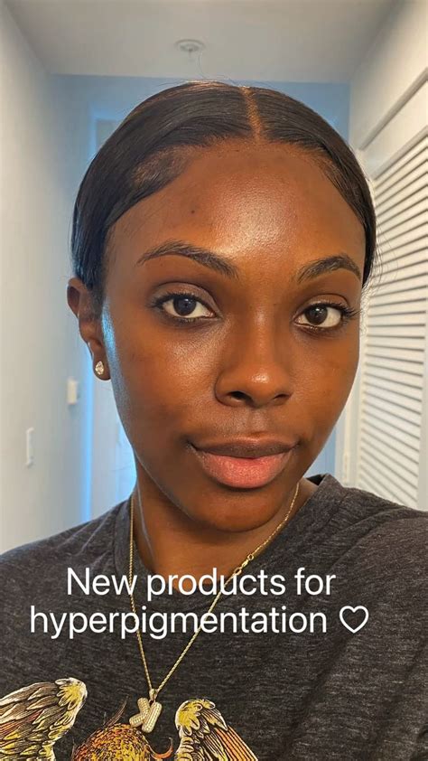 How To Get Clear Skin ♡ Get Rid Of Hyperpigmentation Skin Care