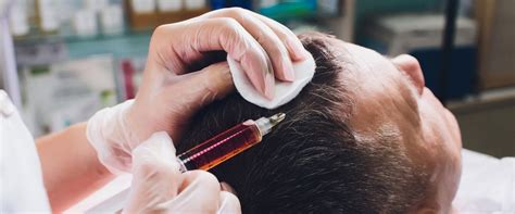 Hair Restoration Harbor Regenerative
