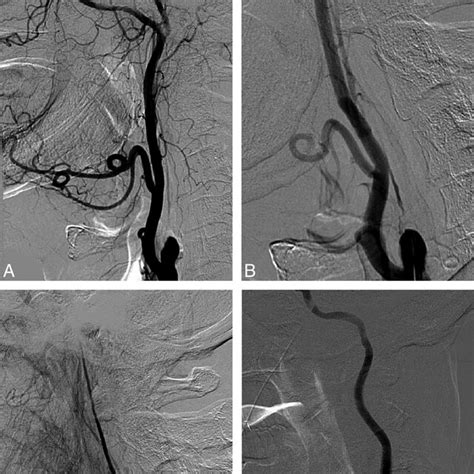 String Sign Def At John Regis Blog