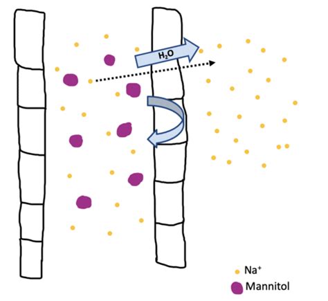 Renal Exam 2 Physiology Diuretics Flashcards Quizlet