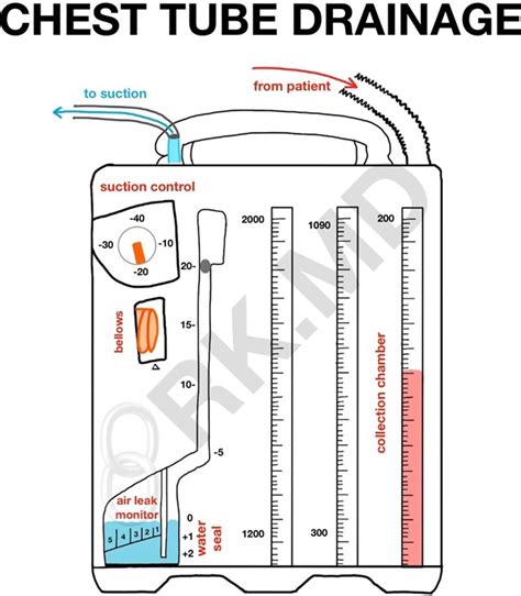 Chest Drainage System Nursing Care At Molly Carmichael Blog