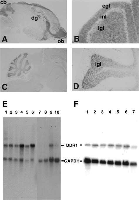 Discoidin Domain Receptor 1 Functions In Axon Extension Of Cerebellar