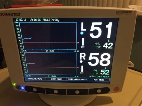 Cerebral And Somatic Nirs Near Infrared Spectroscopy In Shock States