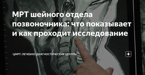 МРТ шейного отдела позвоночника что показывает и как проходит