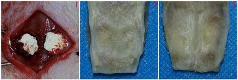 Construction Of Critical Bone Defect Model And Porous Scaffold