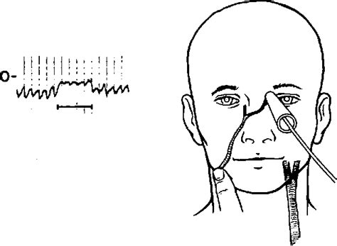 Structure Of Supratrochlear Artery Semantic Scholar