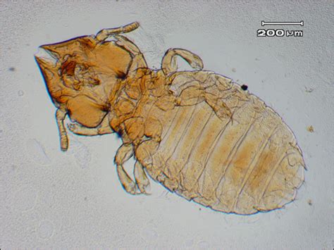 Louse Identification Key