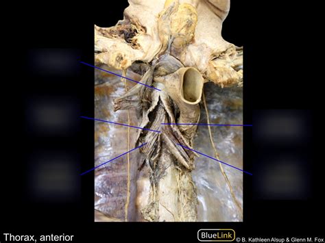 Thorax Anterior Iii Diagram Quizlet