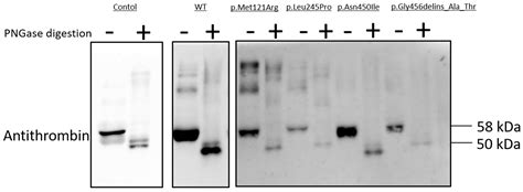 Clinical And Molecular Characterization Of Nine Novel Antithrombin