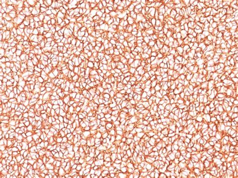 Cd99mic2 Ewings Sarcoma Marker Monoclonal Antibody Spm586 4267