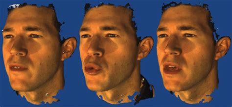 4d Capture Of 3d Facial Images Can Be Used To Evaluate Facial Download Scientific Diagram