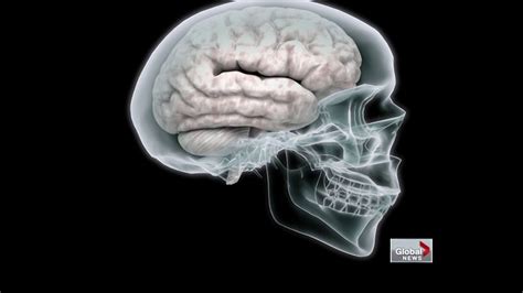 Exercise Makes You Smarter Youtube