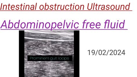 Intestinal Obstruction Ultrasoundabdominal Ultrasound