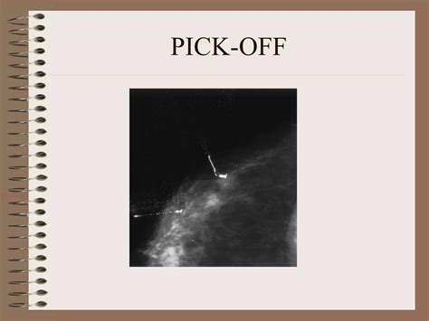 Radiographic Artifacts 2 Ppt