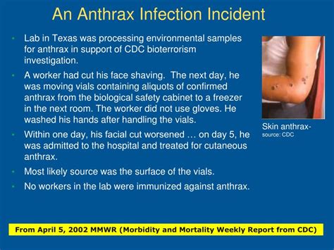 Ppt Biological Hazards In Medical And Research Laboratories