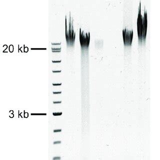 DNA Fragment Length Results For The Six Extraction Methods With 0 5 Download Scientific