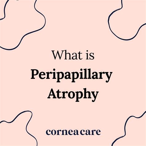 Peripapillary Atrophy Corneacare
