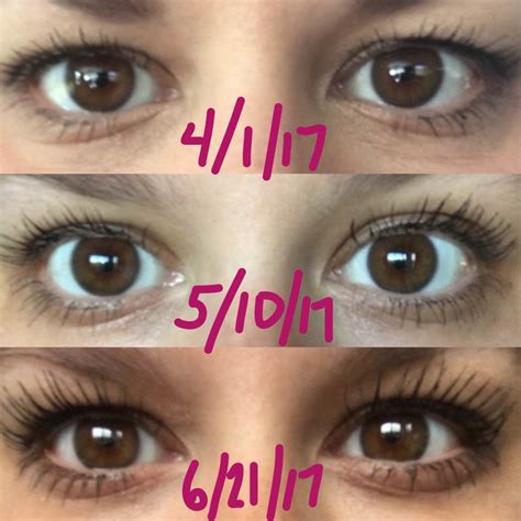 Top Pictures Babe Lash Before And After Pictures Superb