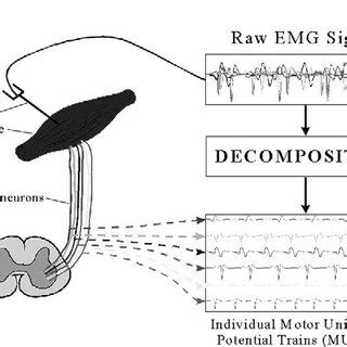 Pdf Techniques Of Emg Signal Analysis Detection Processing