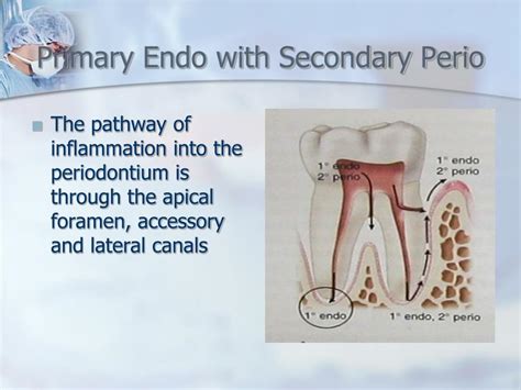 Ppt Anatomic Considerations Powerpoint Presentation Free Download