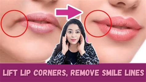 How To Fix Droopy Lips