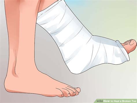 How To Heal A Broken Toe 13 Steps With Pictures WikiHow