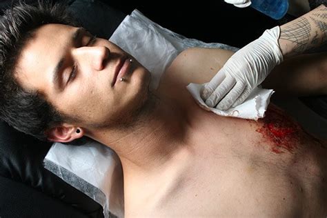 Subincision And Bisection