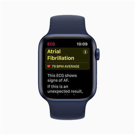 Ecg App And Irregular Rhythm Notification Now Available On Apple Watch