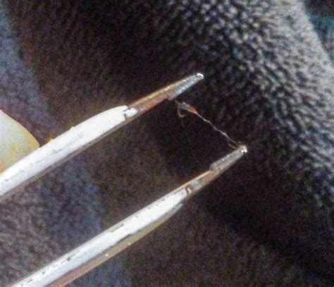 So I Have A Lump Growing Out Of My Forehead Photo What Could It Be