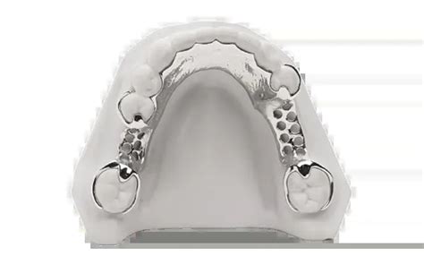 Framework Nsw Dental Lab