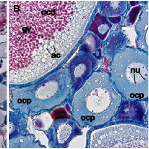Histological Section Of The Gonad Of An Intersex Nile Tilapia