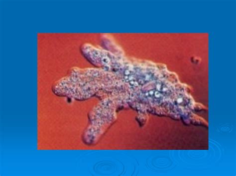 Kingdom Protista Part I Presentation Biology