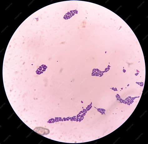 Candida 콜로니 또는 Candida Albicans를 보여주는 현미경 보기에서 그람 염색 프리미엄 사진