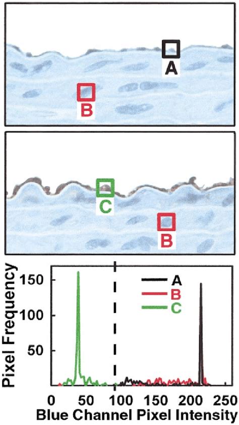 Semi Quantitative Digital Image Analysis Method For Rat Aortic